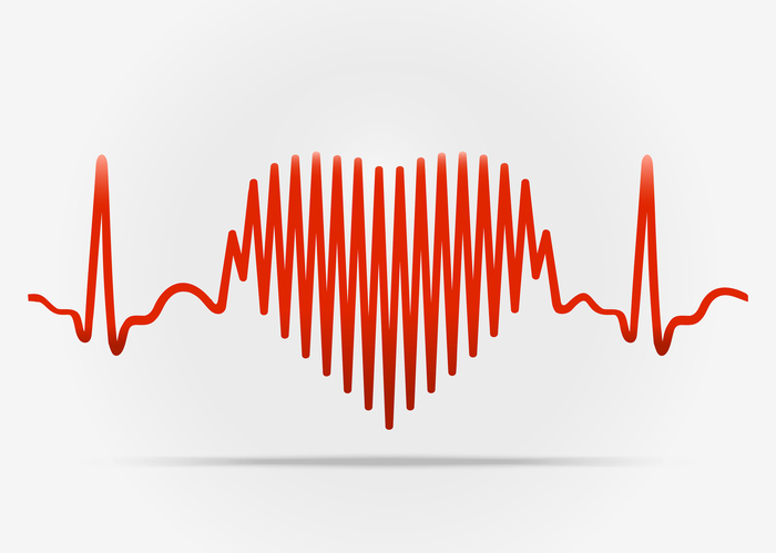 Arrhythmia: What is a cardiac arrhythmia and how is it manifested ...