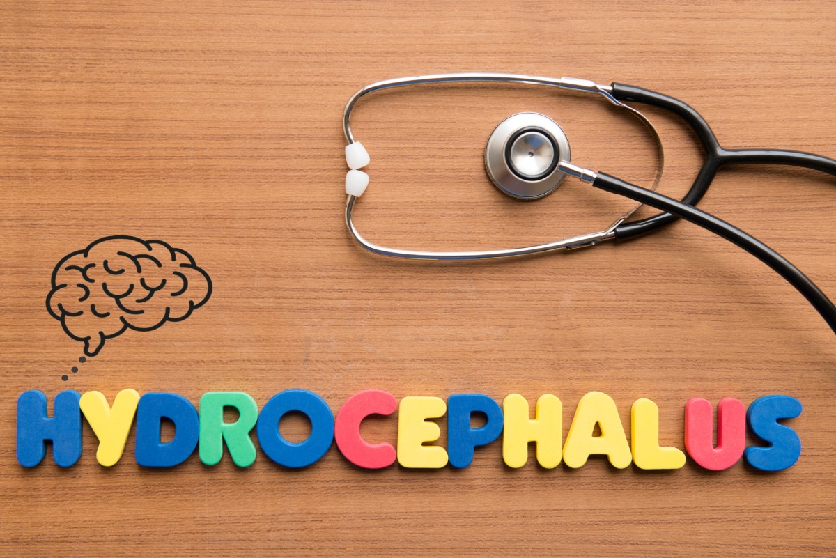 Hydrocephalus: What is it and why does it occur? What are the symptoms ...