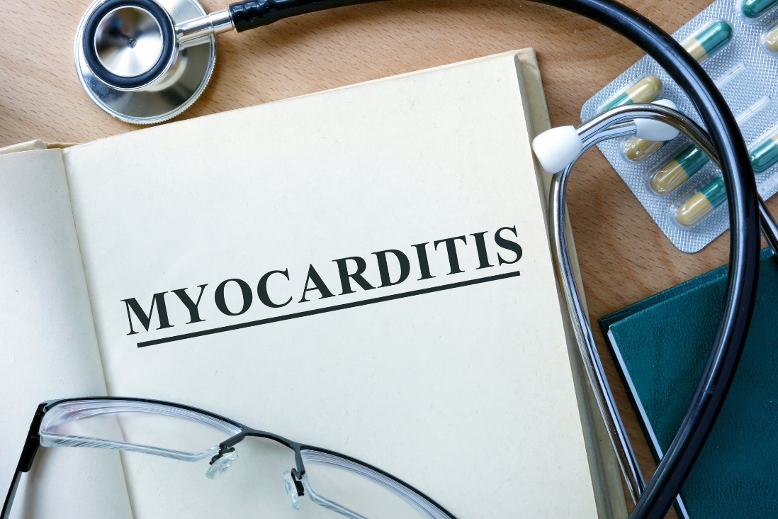 Myocarditis: inflammation of the heart muscle. Myocardial infarction, a ...