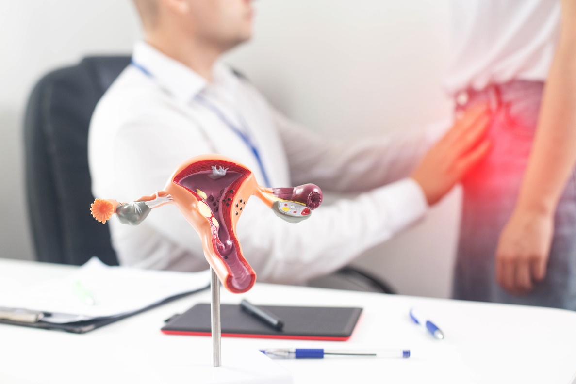 Myoma of the uterus: cause, symptoms. Is it dangerous for a woman ...