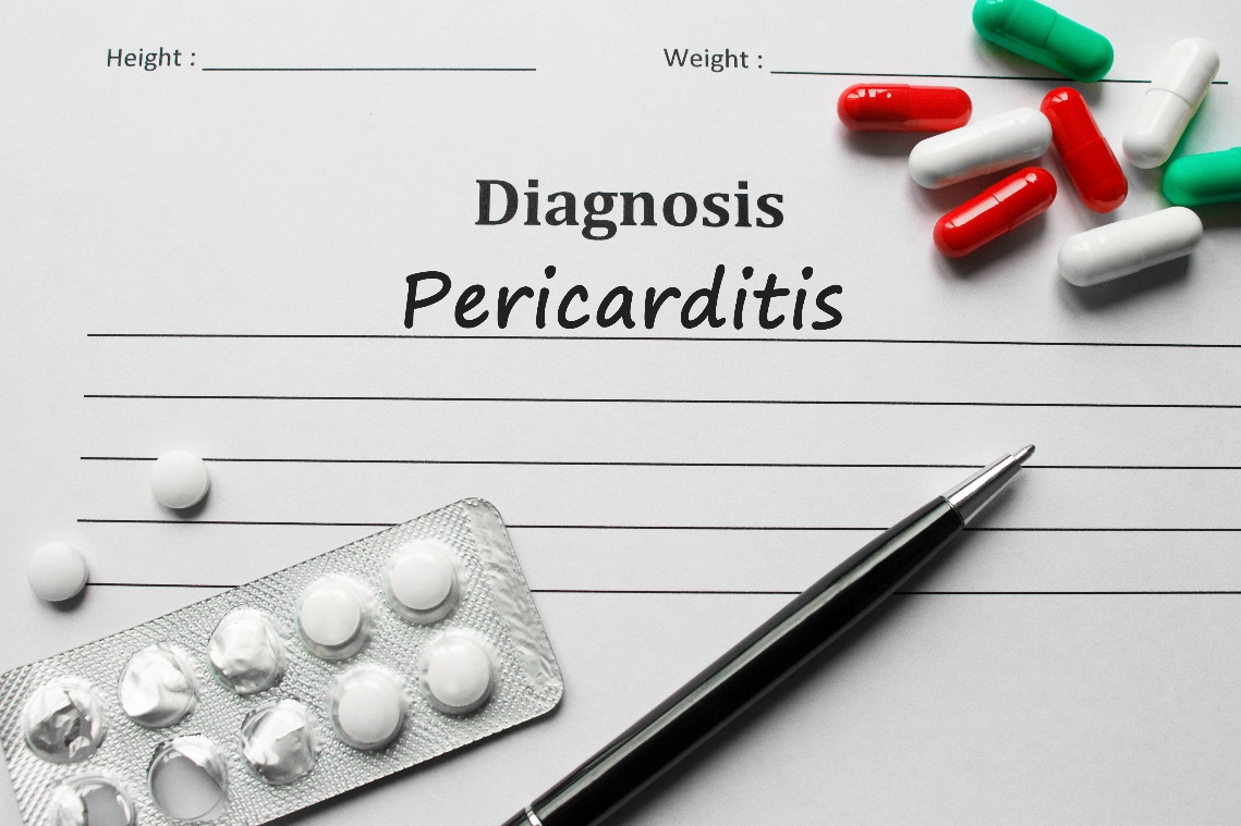 Pericarditis: inflammation of the heart lining. What are its causes and ...