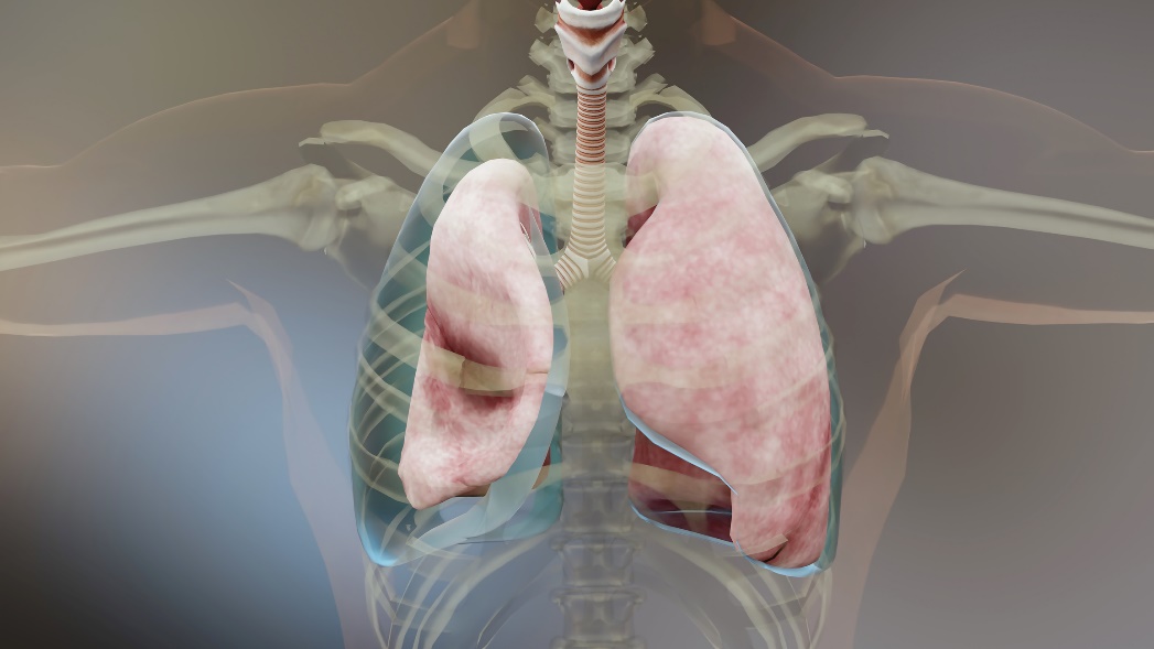 Pneumothorax (air in the chest): causes, symptoms and first aid ...