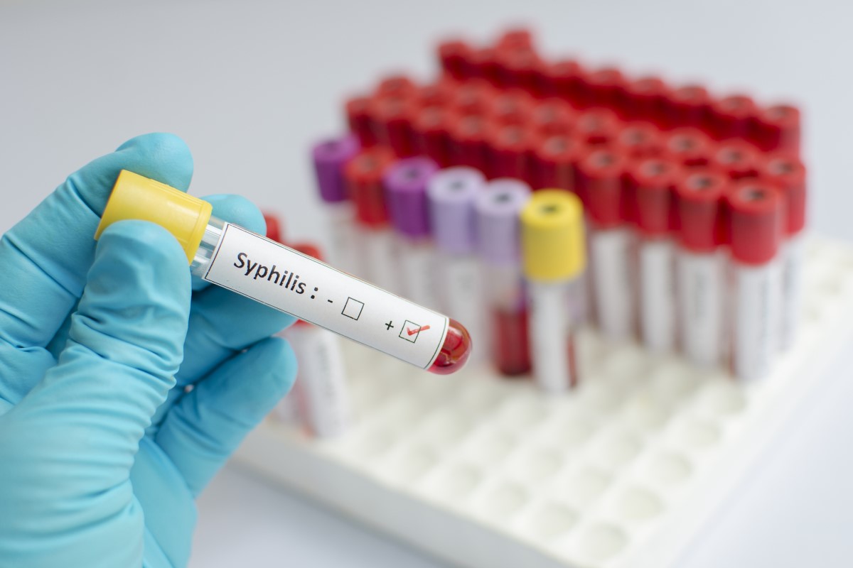 Syphilis treatment: antibiotics and other medications. - MedicSpark.com