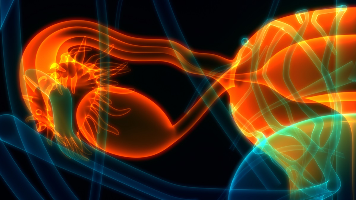 Inflammation of the Ovaries and Inflammation of the Uterine Appendages ...
