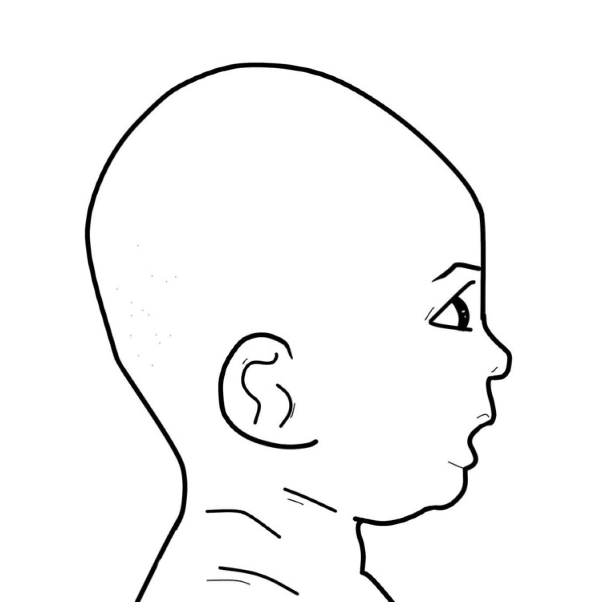 Plagiocephaly in children. What positional head deformities are we ...