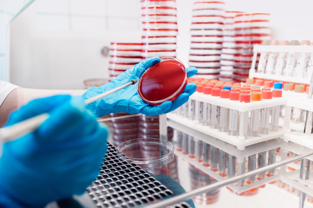 What is blood poisoning - sepsis? What are its symptoms, how does it ...