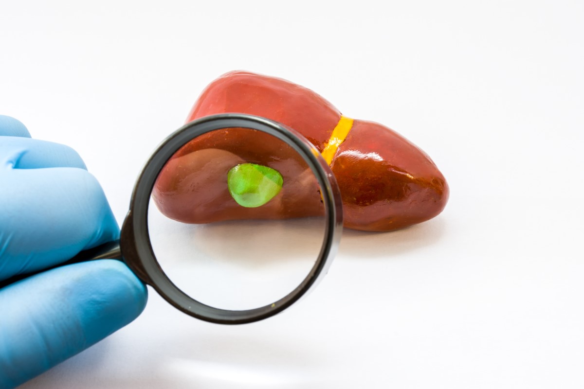 Bile and gallbladder: what are their functions? The formation of bile ...