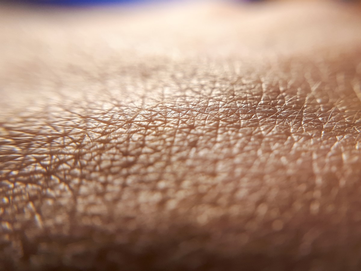 What is an ulcer, types of ulcers, their causes, symptoms and treatment ...