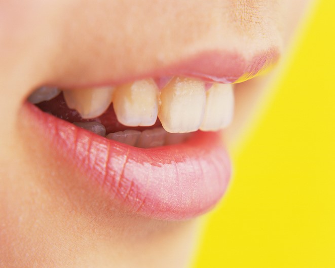 Teeth wobbling: what are the causes (in adults and children)? - symptom ...